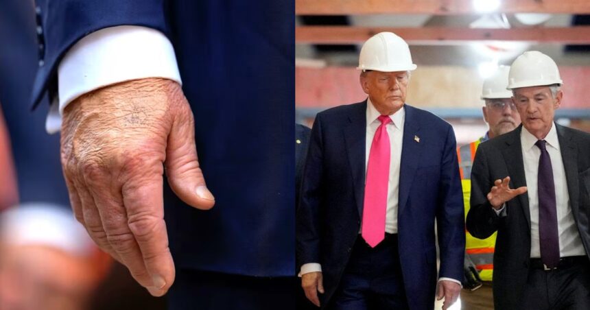 Donald Trump’s Hand Makeup Returns—And So Do the Questions About His Health
