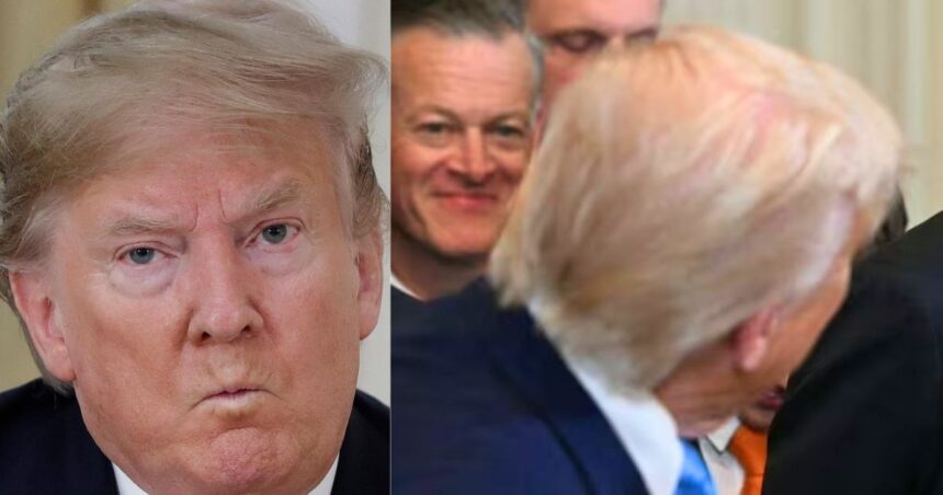 Donald Trump’s Balding Hair Fails Miserably to Mask the Reality of ...